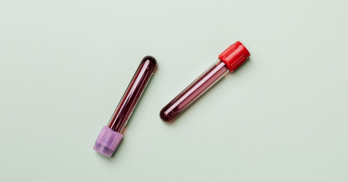 New NHS blood test for preclinical Alzheimer’s raises more questions ...